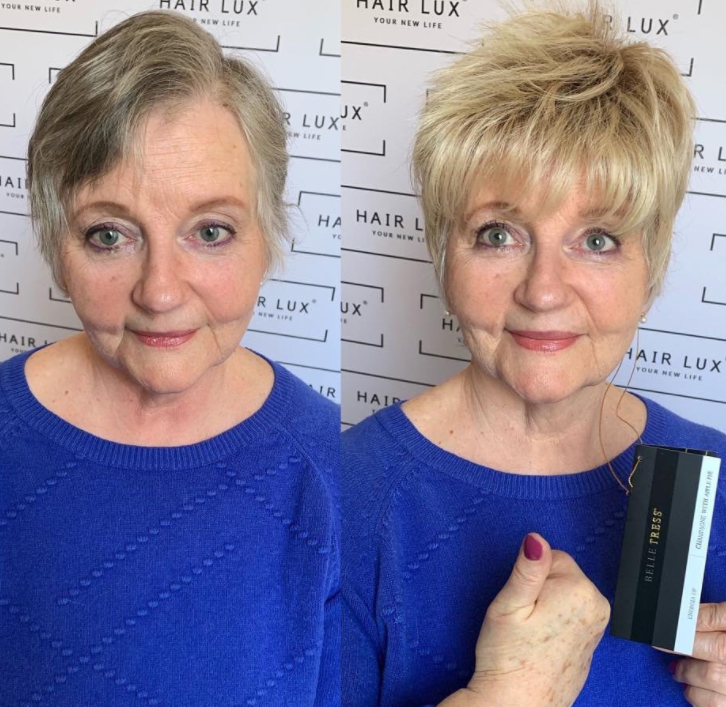 Cover Thinning Crown with this Magic Hair Topper, Super Natural – VIVACROWN